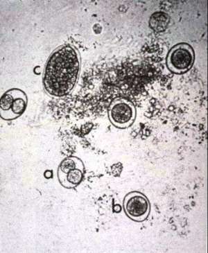 Flashcards - Parasitology Lab: Protozoans slides