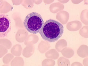 Flashcards - Chapter 8: Erythropoeisis and destruction