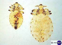 Flashcards - Ectoparasites (flea and lice)