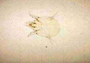 Flashcards - Ear Cytology