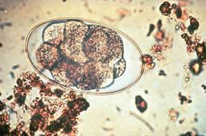 Flashcards - Endoparasites