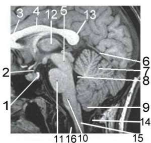 Flashcards - FSP Brain - (Sagittal - COW)