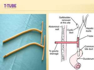 Flashcards - CST Exam 2