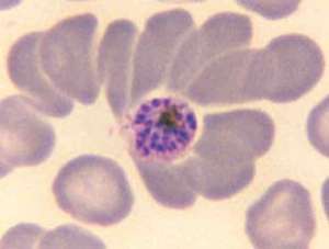 Flashcards - Parasite Lab#2 (Set 5)