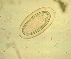 Flashcards - Endoparasites