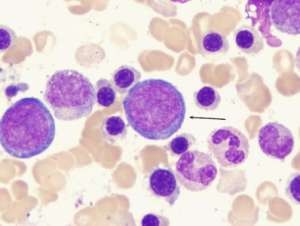 Flashcards - Chapter 8: Erythropoeisis and destruction