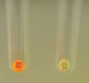 Flashcards - CLS05 - Biochemical test media for GNB