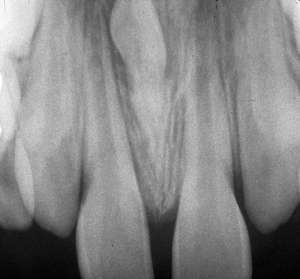 Flashcards - more dental anatomy terms