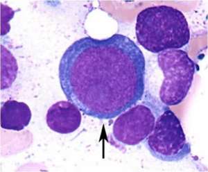 Flashcards - Chapter 8: Erythropoeisis and destruction