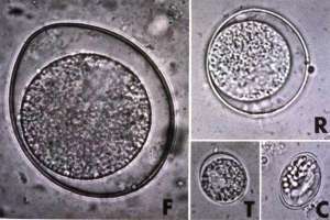 Flashcards - Parasitology Lab: Protozoans slides