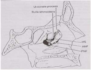 Flashcards - ENT Rhinology