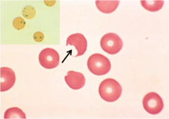 Flashcards - Chapter 9: Energy metabolism and membrane physiology of ...