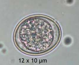 Flashcards - Diagnosis of Parasites