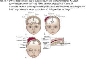 Flashcards - Childbearing Family Nursing