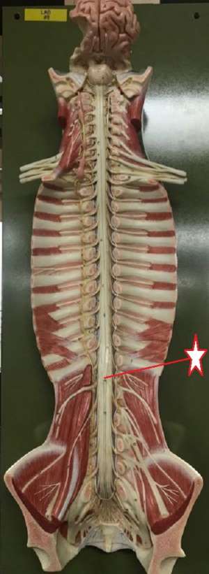 Flashcards - LAB 8 – SPINAL CORD, AUTONOMIC AND SOMATIC REFLEXES AND ...