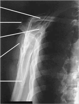 Flashcards - Unit 5 (Shoulder Girdle)