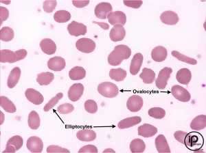 Flashcards - Hematology Exam 2