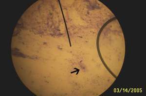 Flashcards - Fecal Cytology