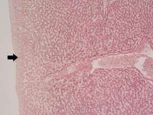 Flashcards - liver--Bloc two histology