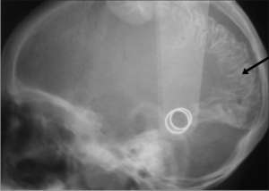 Flashcards - Radiology