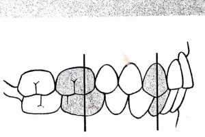 Flashcards - Dental Anatomy Final
