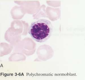 Flashcards - Chapter 8: Erythropoeisis and destruction