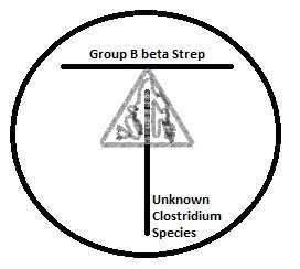 Flashcards - Procedures and Biochemical Identification of Bacteria