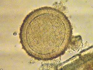 Flashcards - Equine Internal Parasites