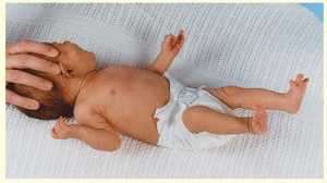 Flashcards - Clin Skills Pediatrics