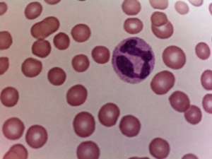 Flashcards - Hematology Diff Slide ID