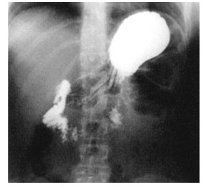Flashcards - RTE1513RadProceduresII