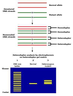 Flashcards - Genetics diagnosis