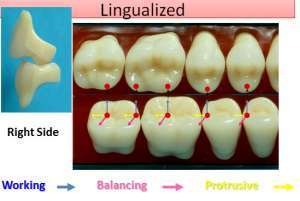Flashcards - Dentures Lingualized