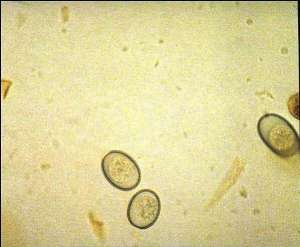 Flashcards - Parasitology Lab: Protozoans slides