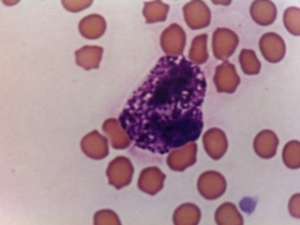 Flashcards - Hematology Diff Slide ID