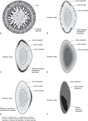Flashcards - organum visus III obsah