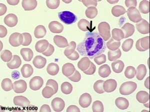 Flashcards - Leukocytes