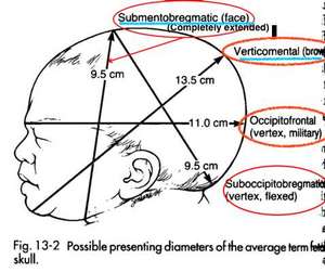 Flashcards - Obstetrics 11