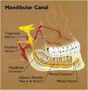 Flashcards - DHE 116 chapter#21 Radiographic Anatomy quiz