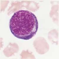 Flashcards - Chapter 8: Erythropoeisis and destruction