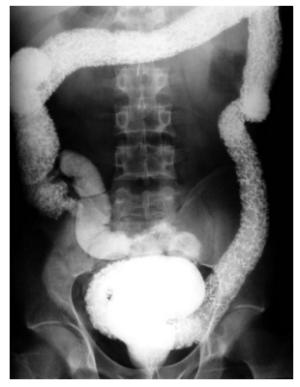 Flashcards - RTE1513RadProceduresII