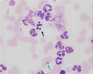 Flashcards - General Cytology Lab