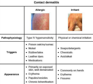Flashcards - USMLE Dermatology I