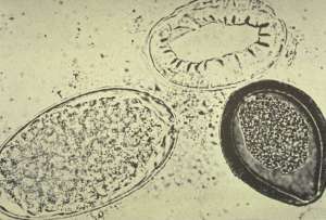 Flashcards - Parasitology Lab: Protozoans slides