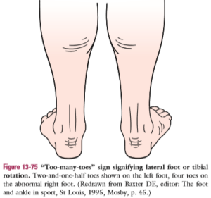 Flashcards - Special Tests