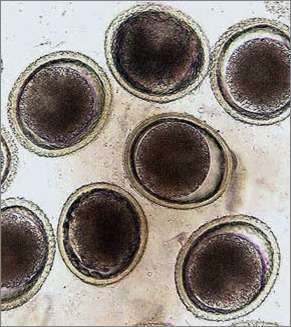 Flashcards - Review of Nematodes