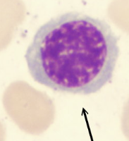 Flashcards - Chapter 8: Erythropoeisis and destruction