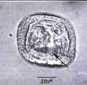 Flashcards - Parasitology lab: Cestode slides 1-35