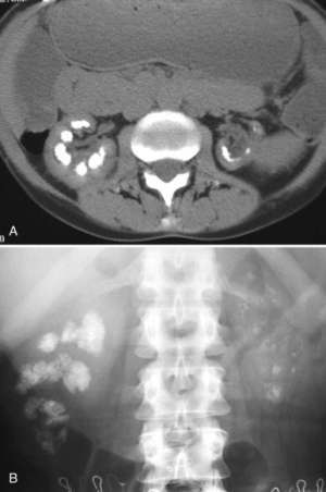 Flashcards - Complet C-46 evaluation and medical management of urinary ...