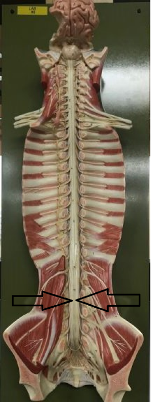 Flashcards - LAB 8 – SPINAL CORD, AUTONOMIC AND SOMATIC REFLEXES AND ...